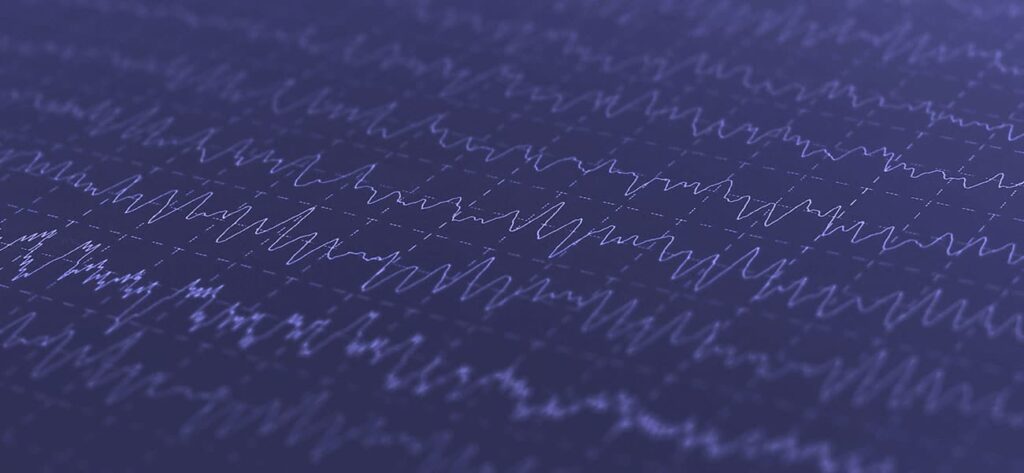 Continuous EEG Monitoring in the ICU - Neuro Training Academy