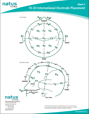 10-20 International Electrode Placement Chart - Neuro Training Academy